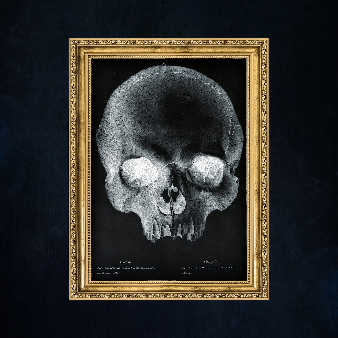 Human Skull Print, Reproduction Art Print, Joseph Vimont, Treatise on ...