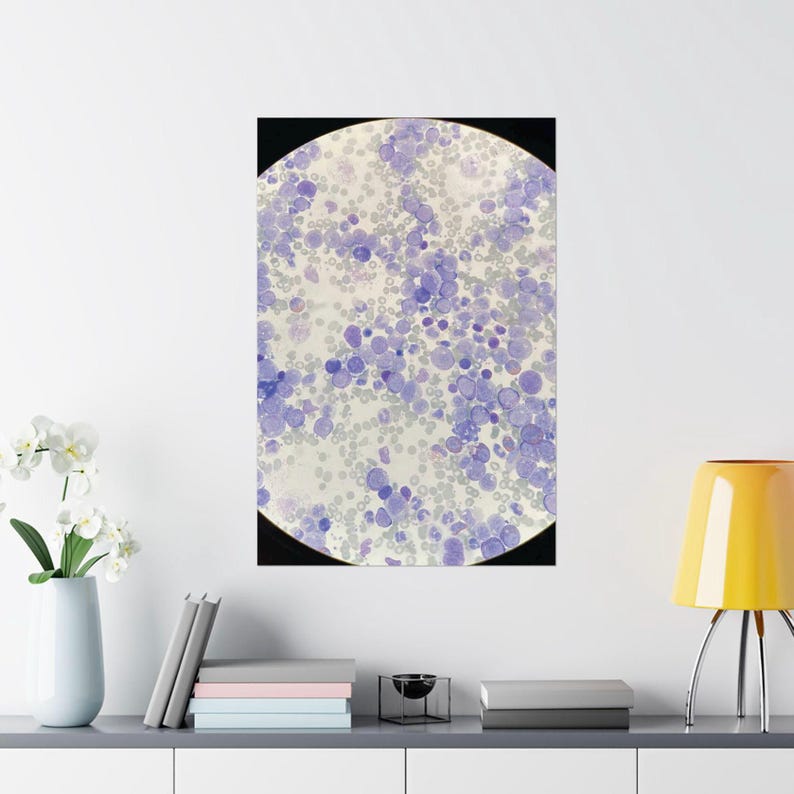 Blood Smear, Medical Art. Science Posters, (210gsm) - Etsy