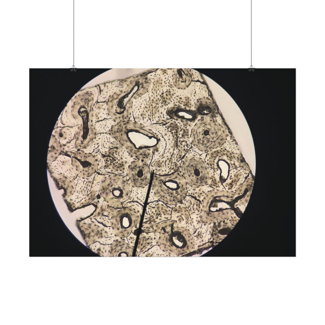 Histology Bone Slide Microscopic Poster, Science Teacher Gift, Healthcare Worker Decor, Medical ...
