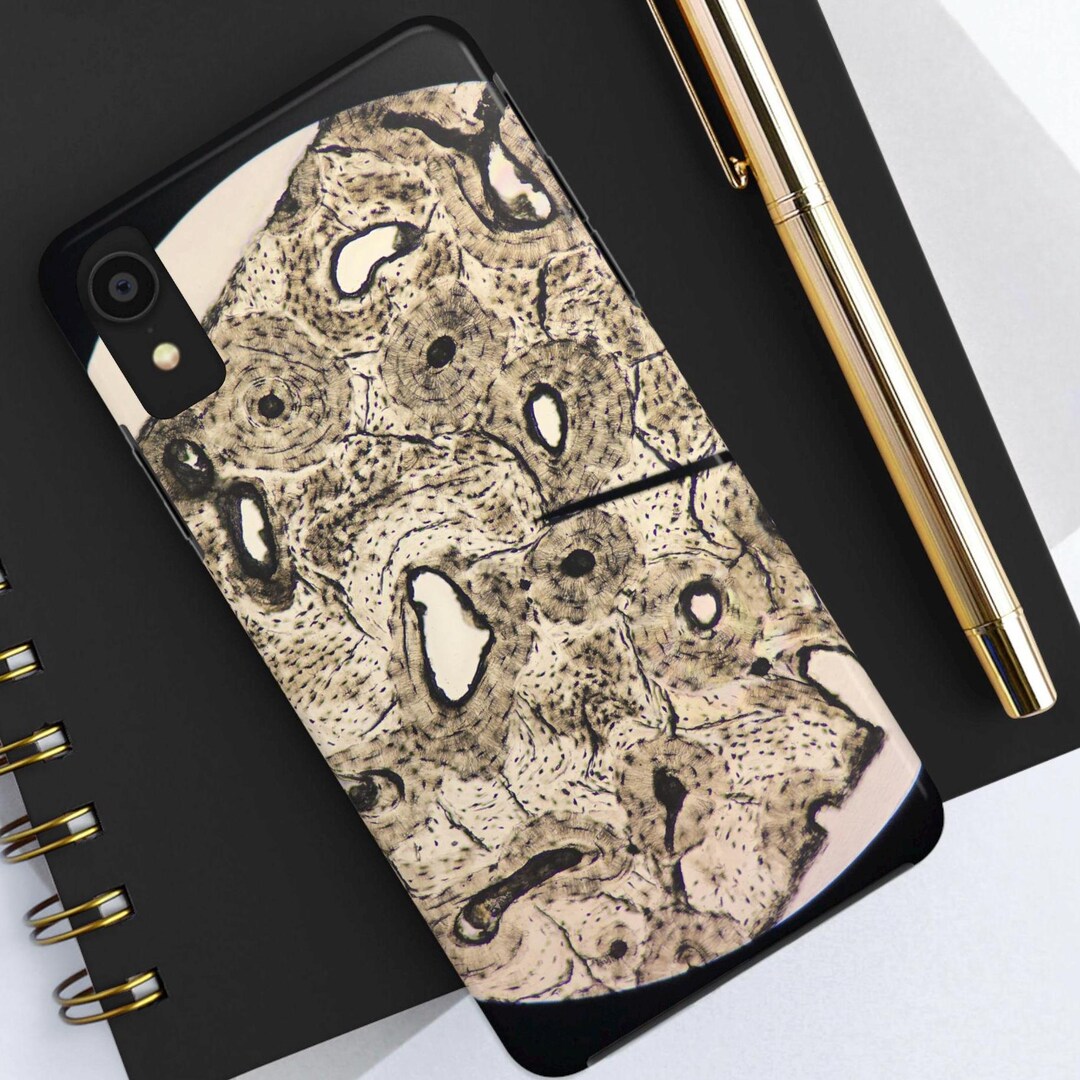 Histology Bone Slide Tough Phone Case, Science, Anatomy, Medical Gift ...