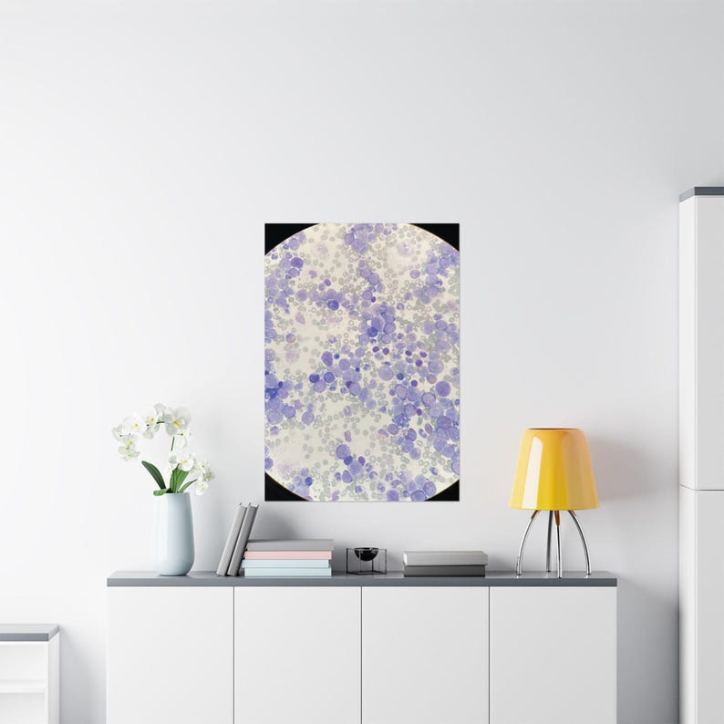Blood Smear, Medical Art. Science Posters, (210gsm) - Etsy Australia