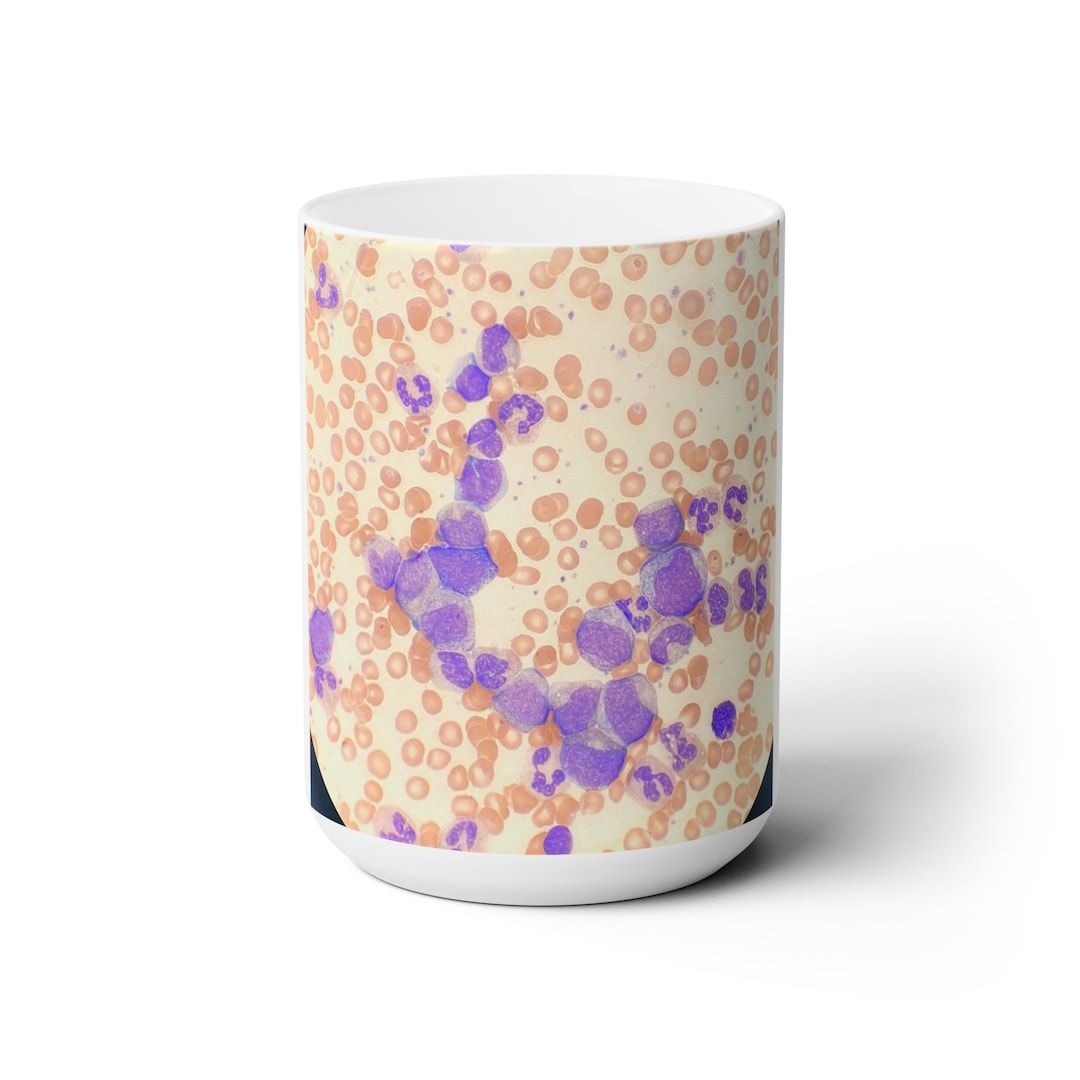 Blood Smear Mug, Hematology Gift for the Medical Scientist in Your Life ...