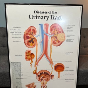 Urinary Tract Diseases Framed Poster - Etsy