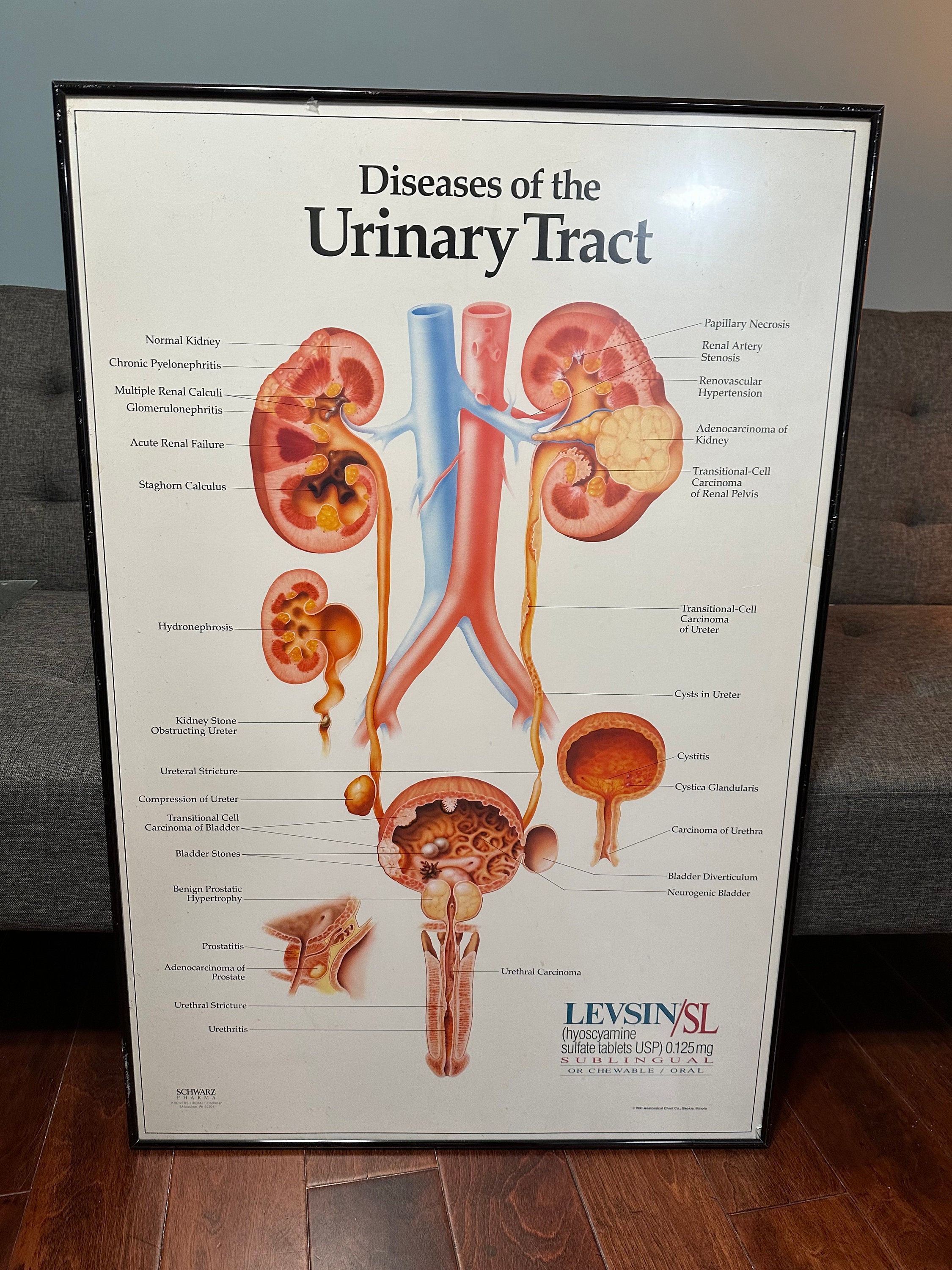 Urinary Tract Diseases Framed Poster - Etsy