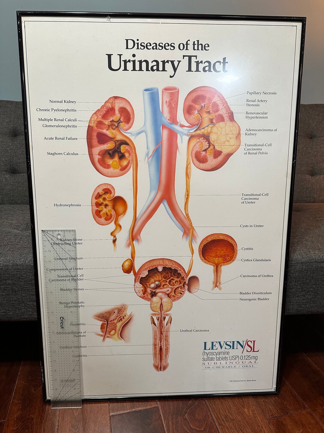 Urinary Tract Diseases Framed Poster - Etsy