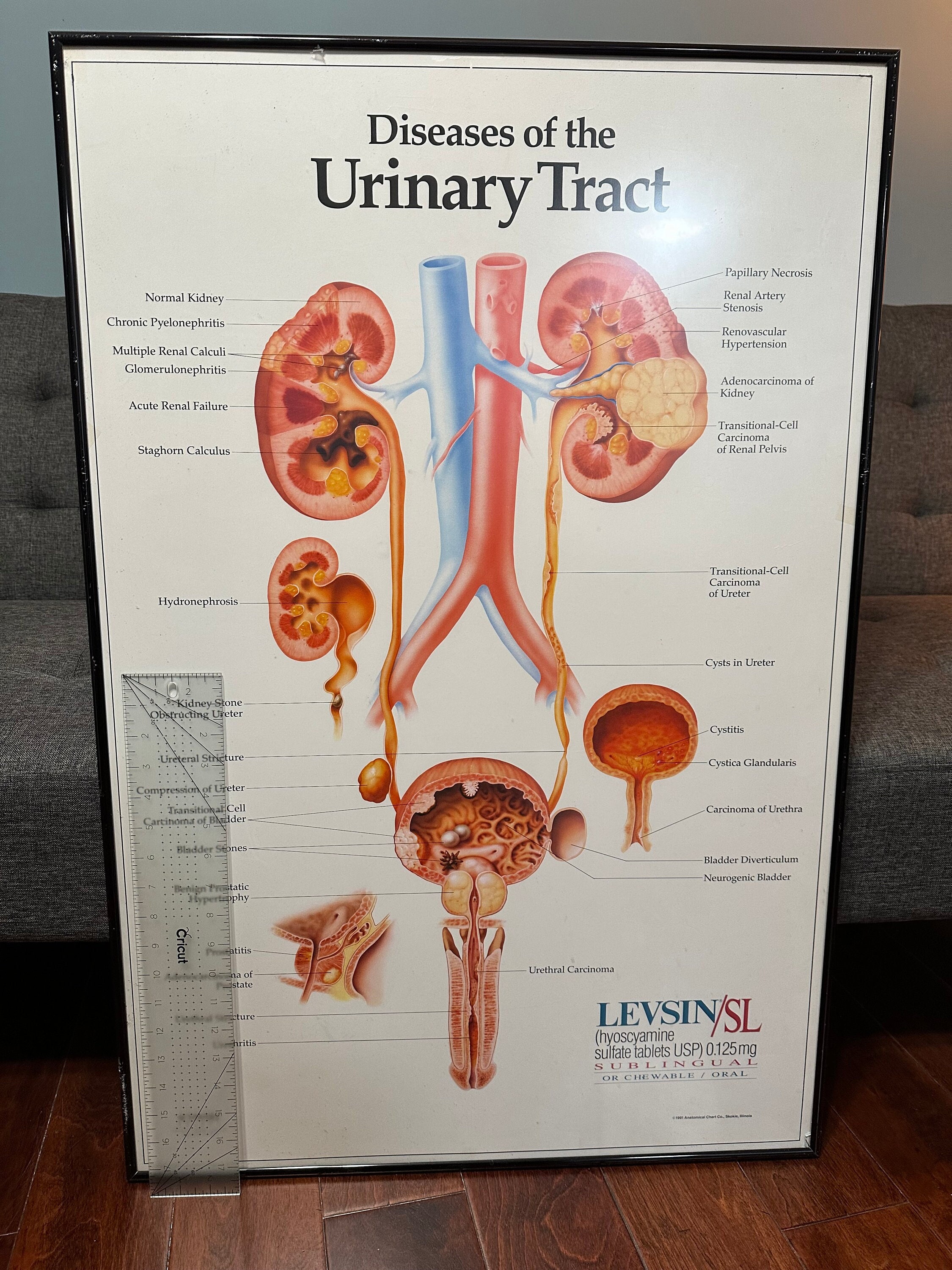Urinary Tract Diseases Framed Poster - Etsy