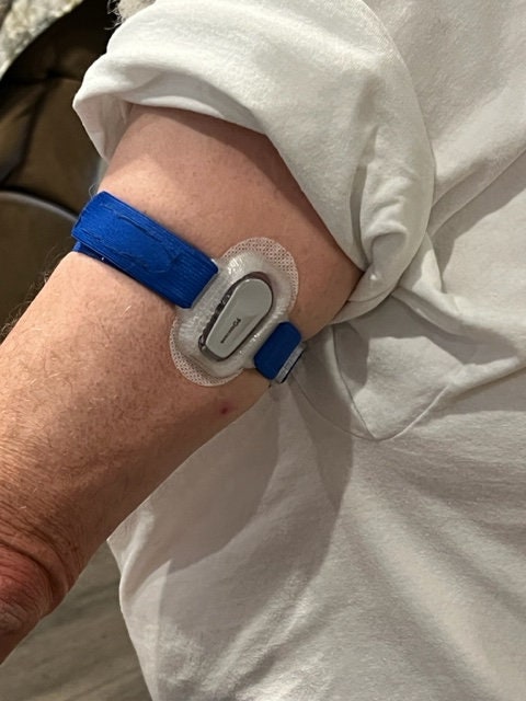 Dexcom G6 CGM Vibrant Bands - Etsy