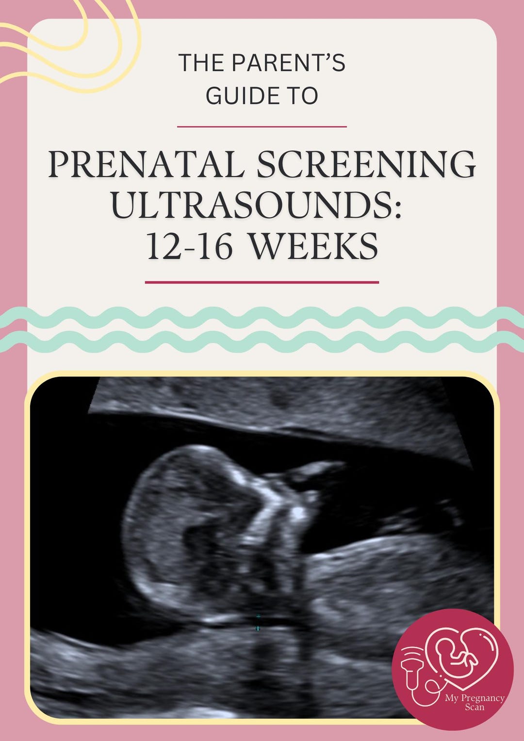 The 12-16 Week Ultrasound Guide for Parents. - Etsy