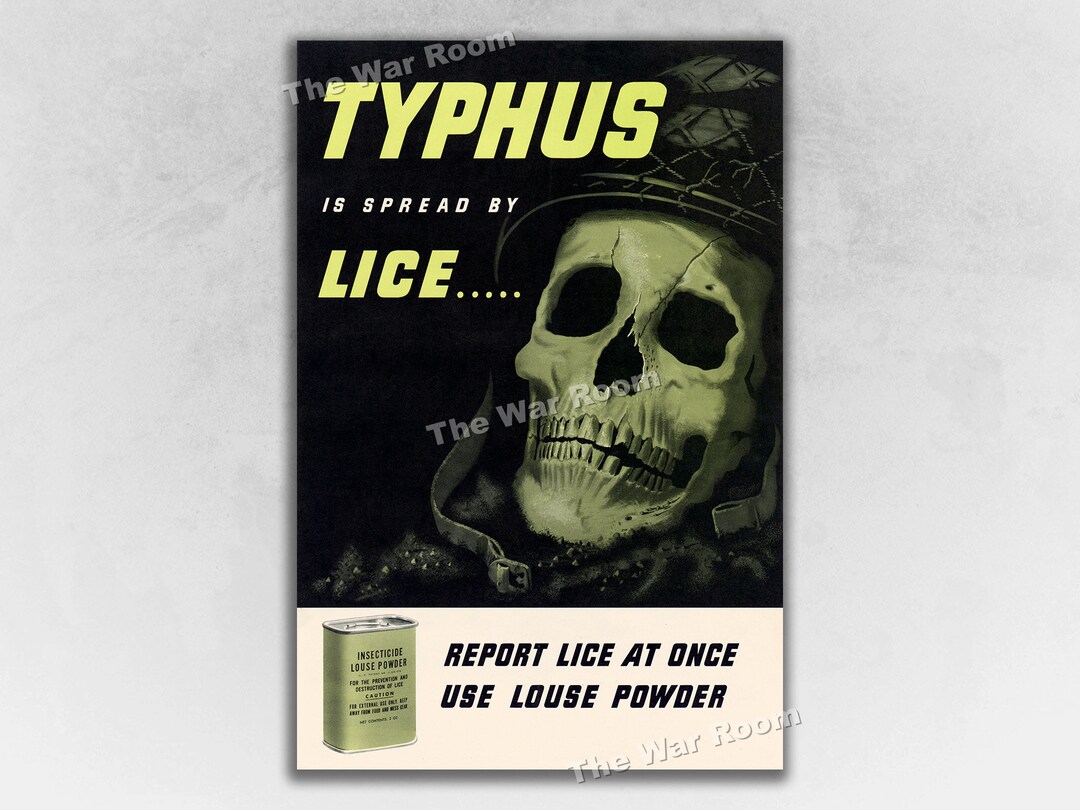 1943 "typhus is Spread by Lice!" - WW2 Era Army Health Poster - Etsy
