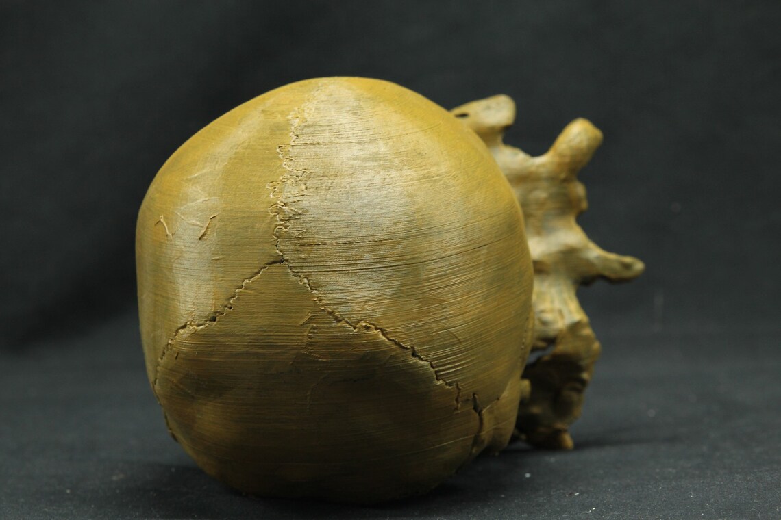 Replica of an Exploded Human Skull MADE TO ORDER - Etsy