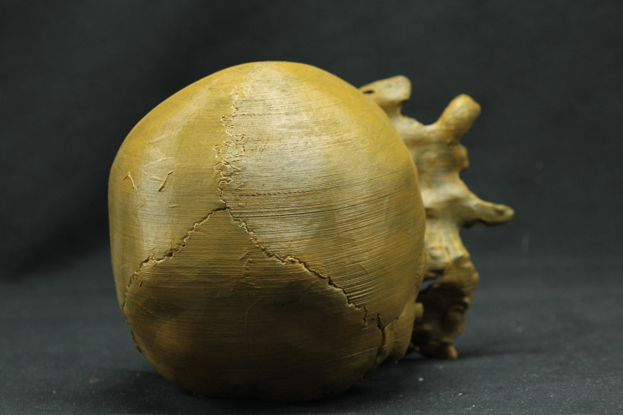 Replica of an Exploded Human Skull MADE TO ORDER - Etsy