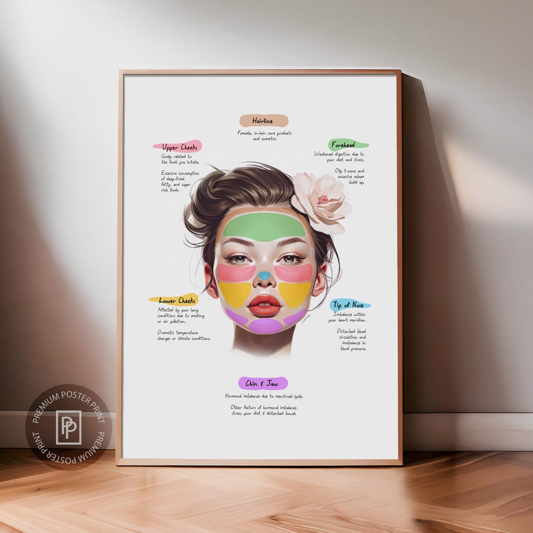 Acne Diagram, Acne Face Map, Esthetician Decor, Premium Poster ...