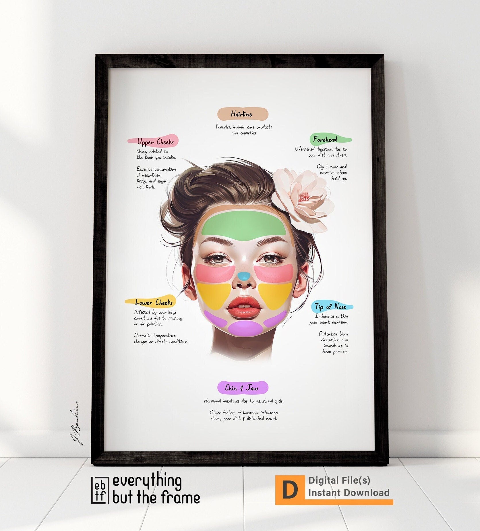 Acne Diagram Model 1, Acne Face Map, Aesthetics Art, Dermatologist Art ...