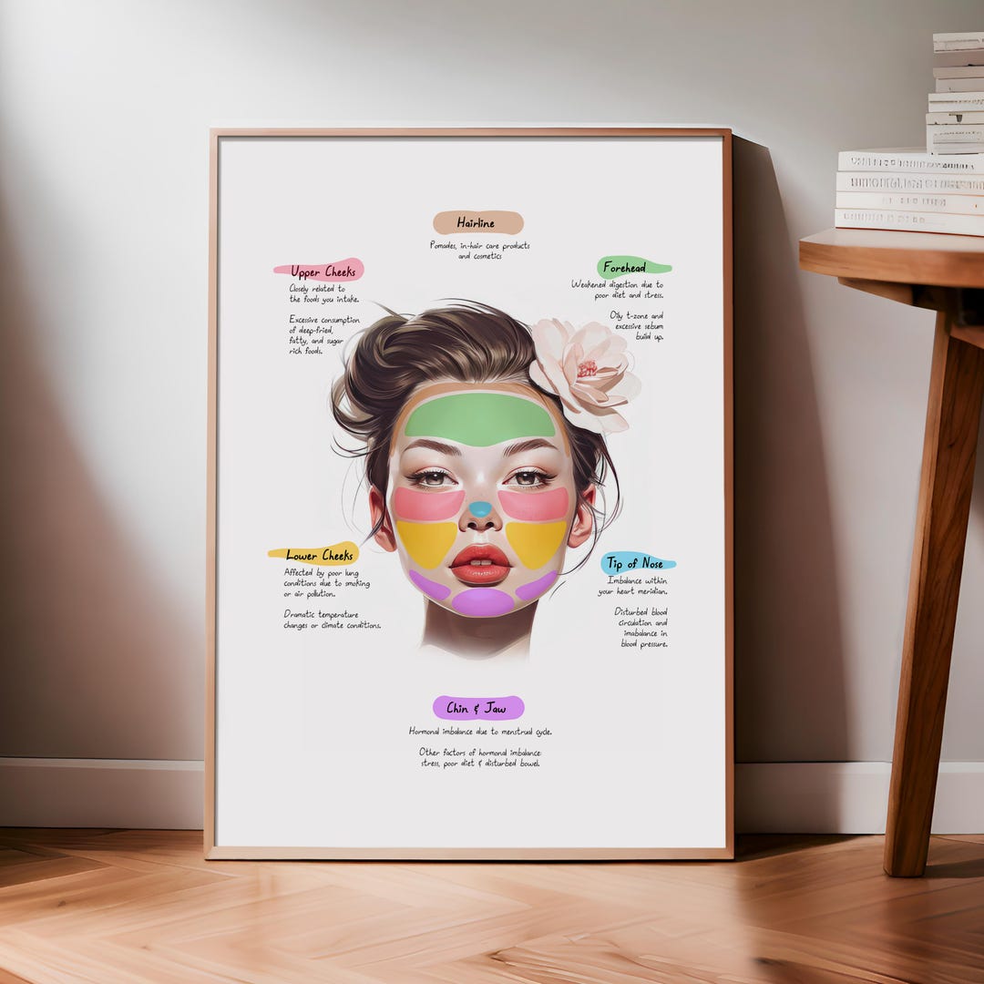 Acne Diagram, Acne Face Map, Esthetician Decor, Dermatologist Art ...