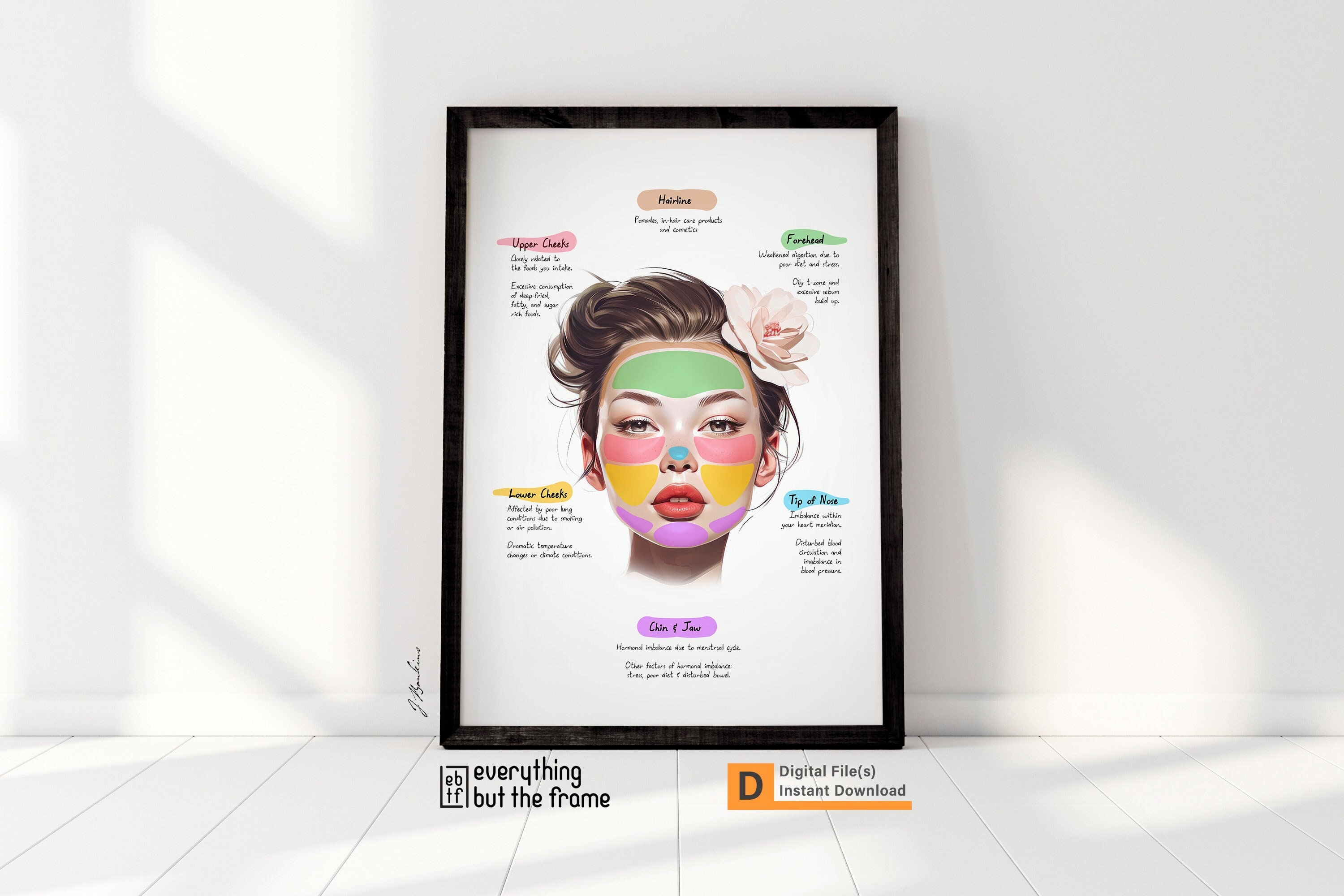 Acne Diagram Model 1, Acne Face Map, Aesthetics Art, Dermatologist Art ...