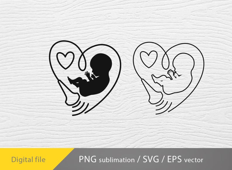 Ultrasound Svg, Ultrasound Heartbit Svg, Ultrasound Probe Transducer ...