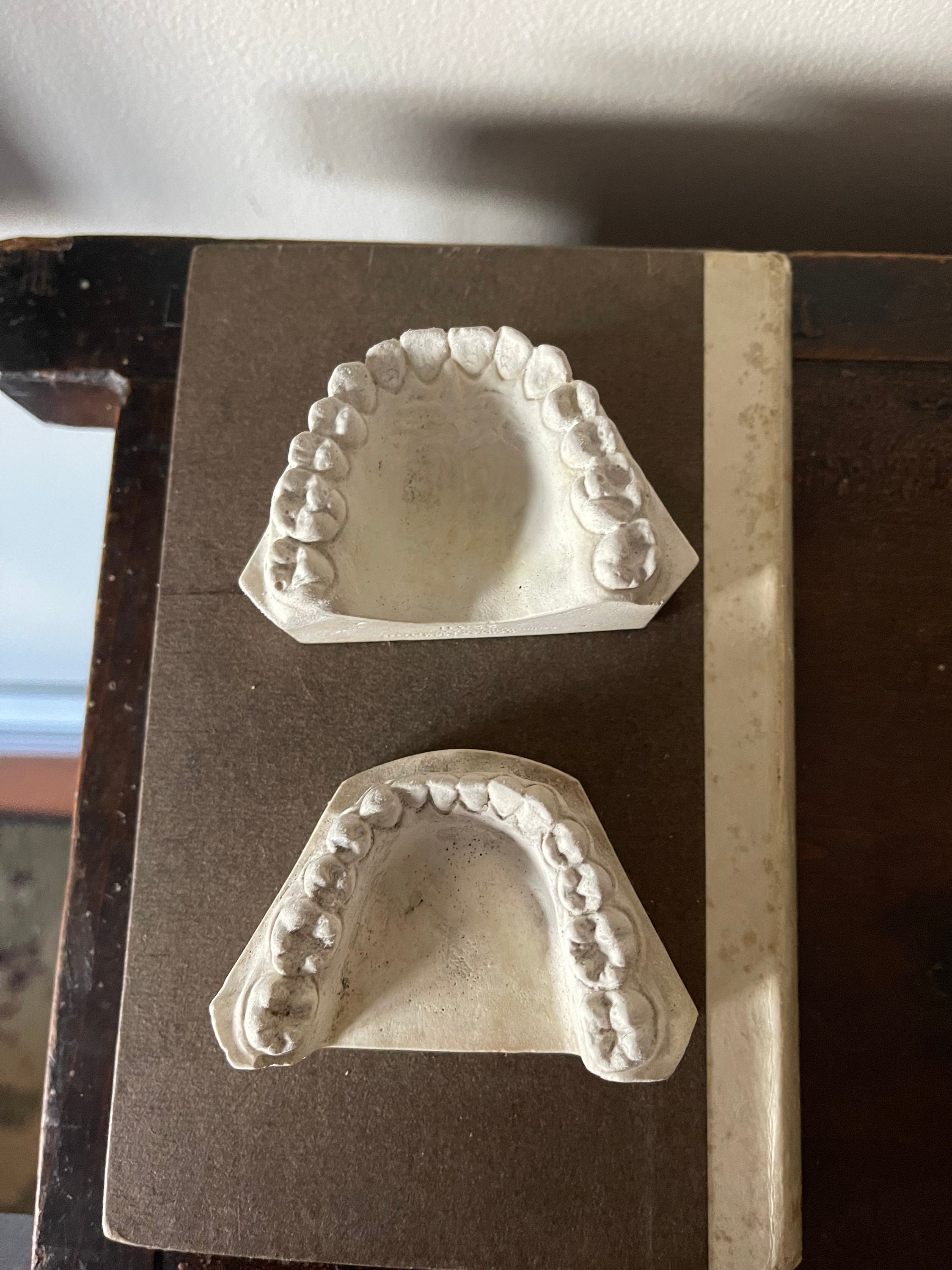 Vintage Plaster Medical Dental Cast - Etsy