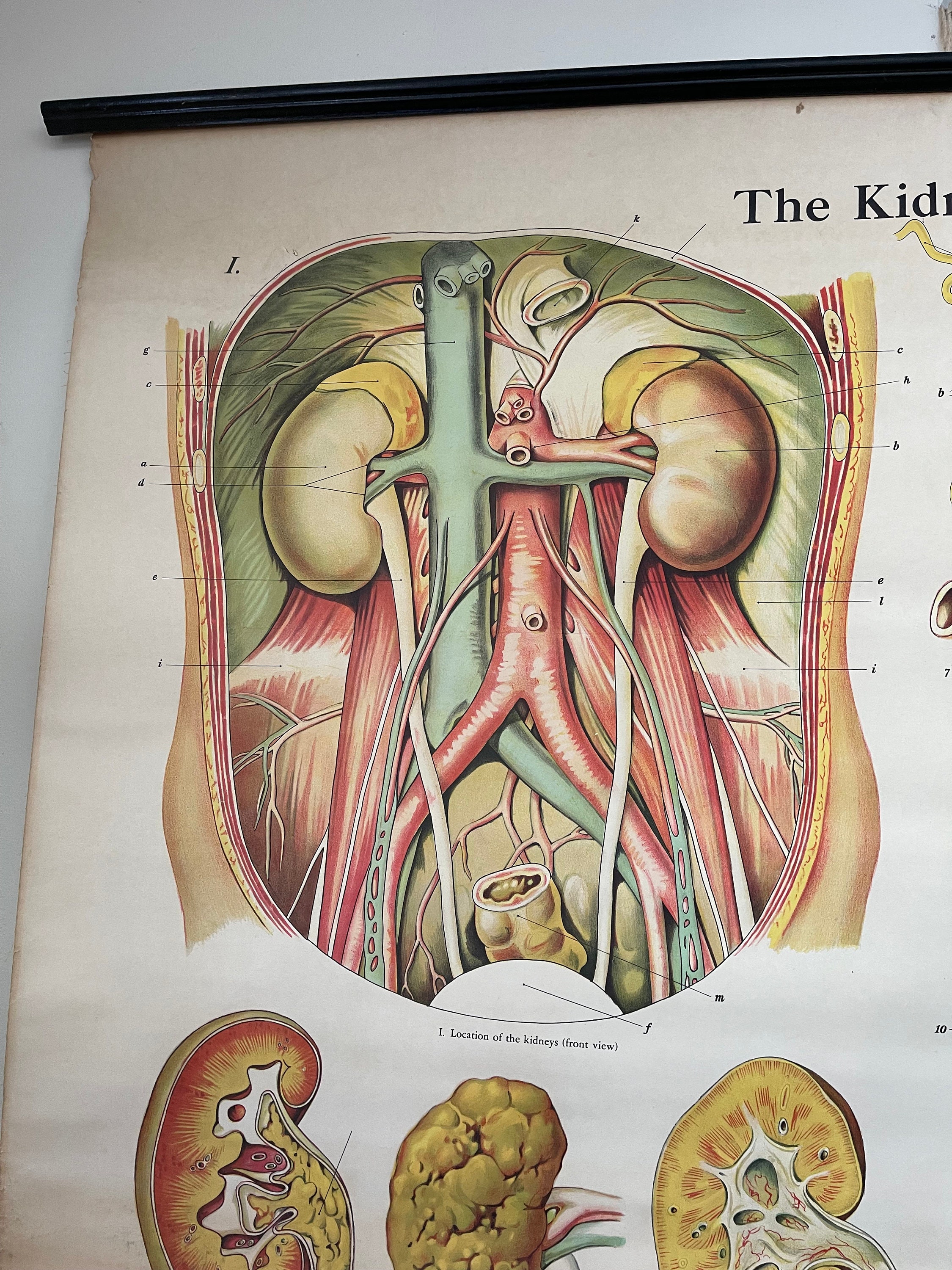 Large Vintage Anatomy Chart of the Kidneys - Etsy