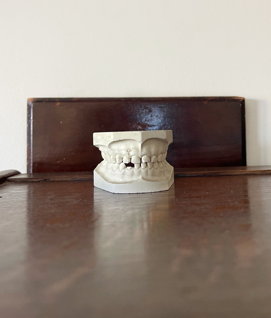 Plaster Cast of Childs Teeth - Etsy