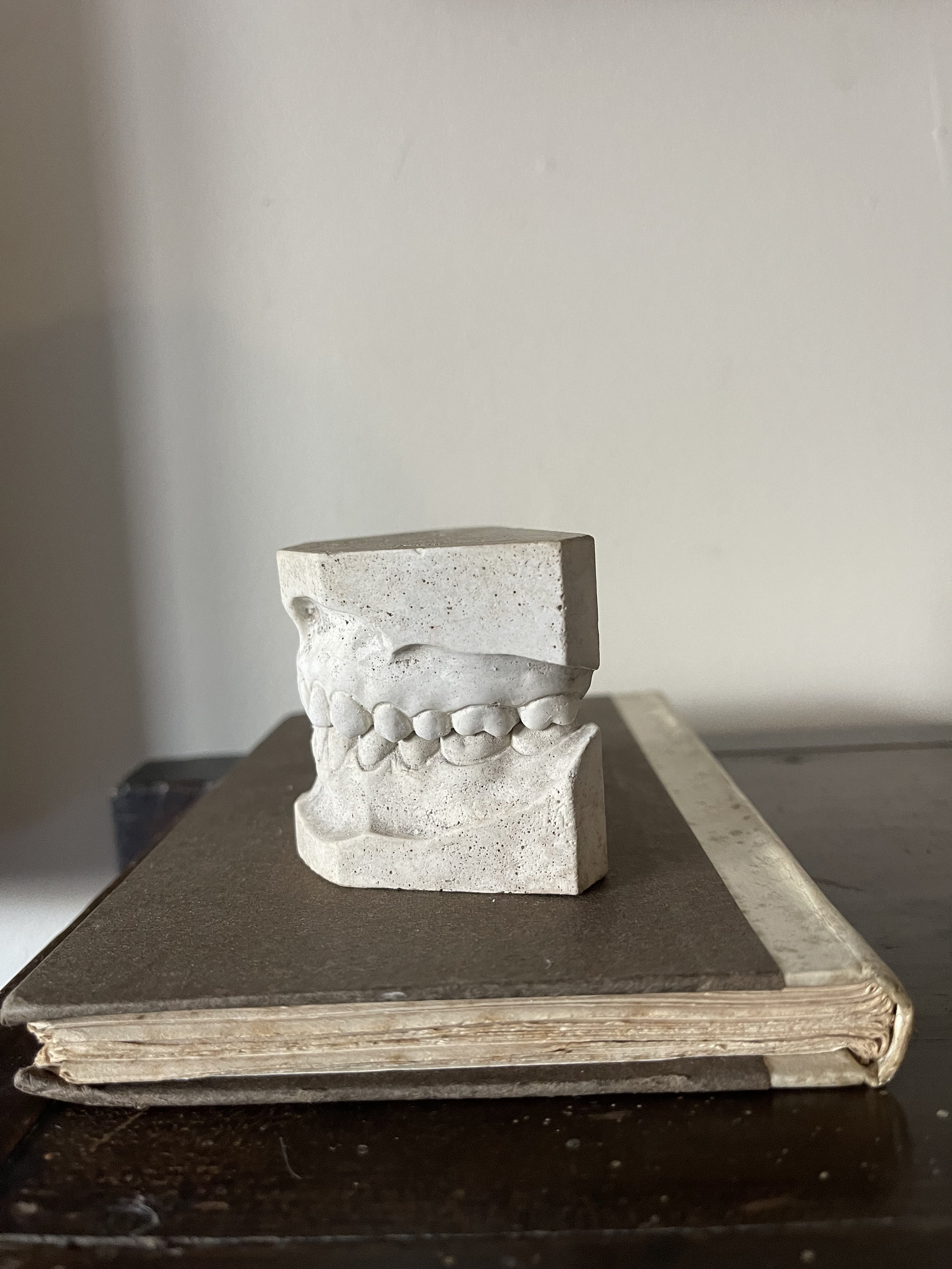 Vintage Plaster Medical Dental Cast - Etsy