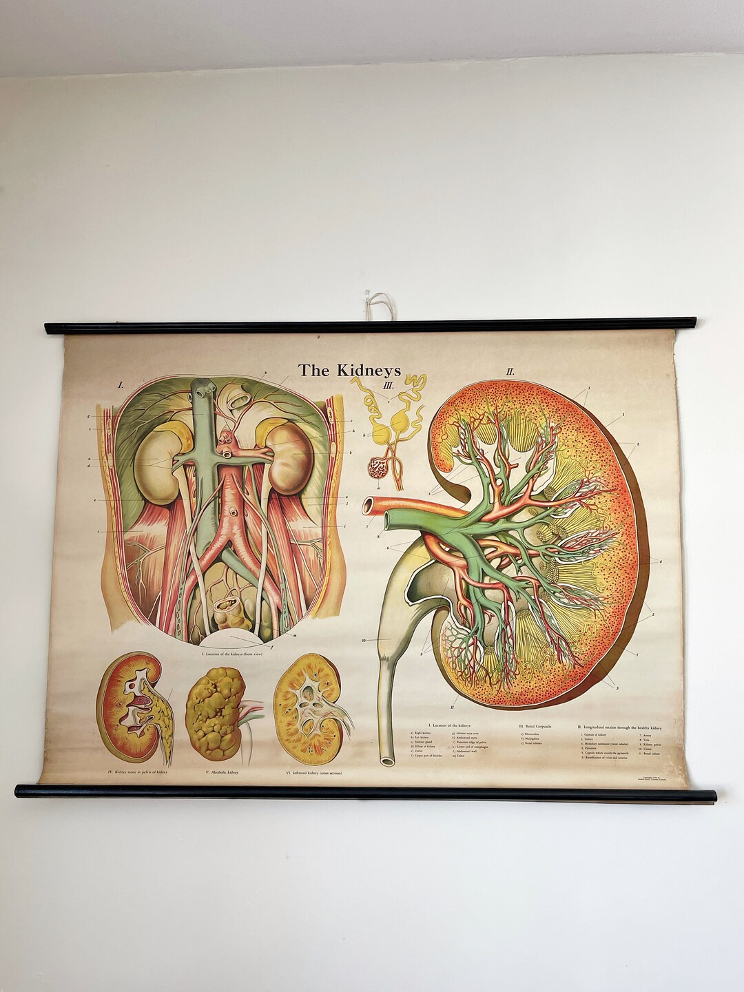 Large Vintage Anatomy Chart of the Kidneys - Etsy