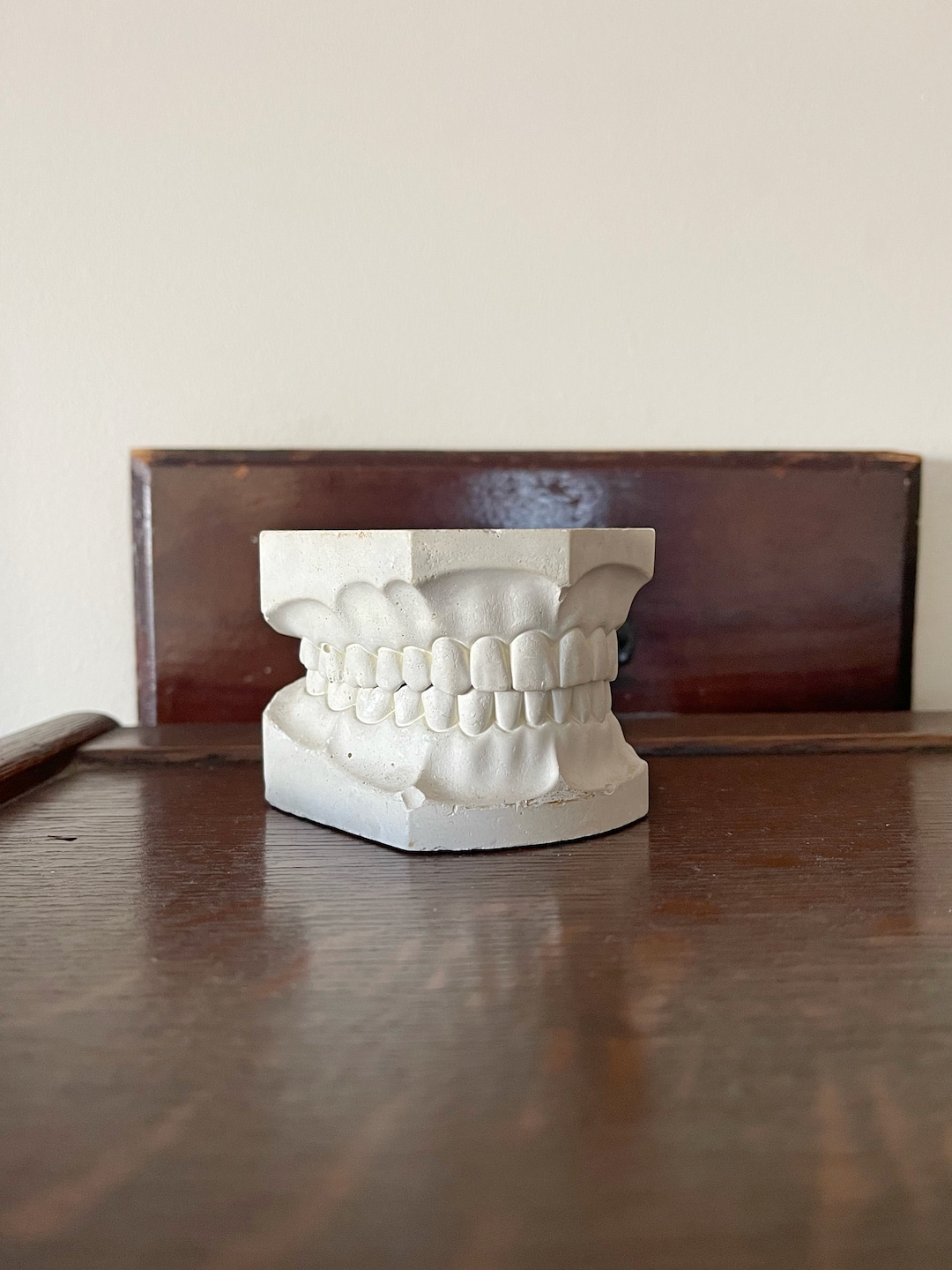 White Plaster Cast of Adult Teeth - Etsy