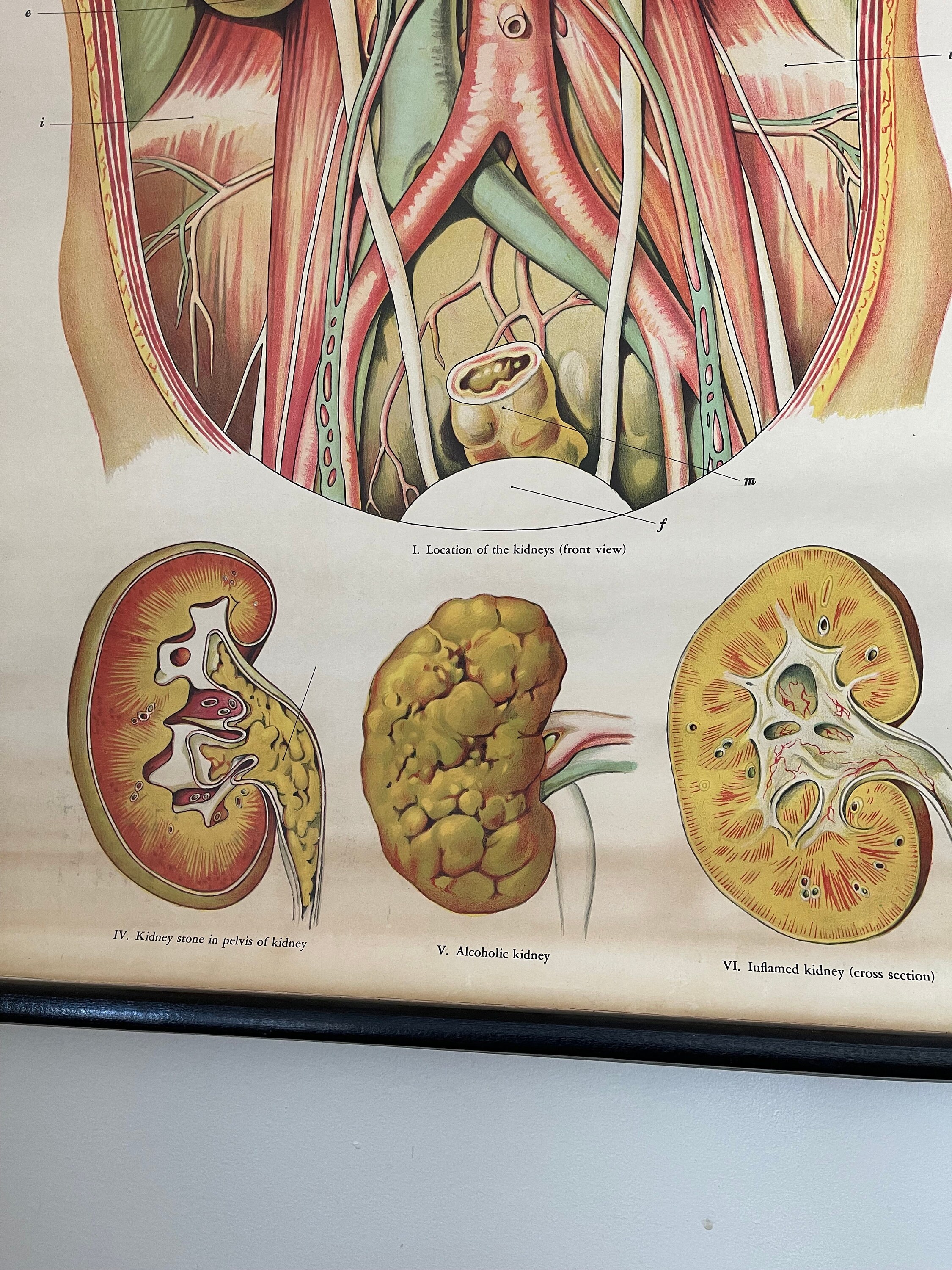 Large Vintage Anatomy Chart of the Kidneys - Etsy