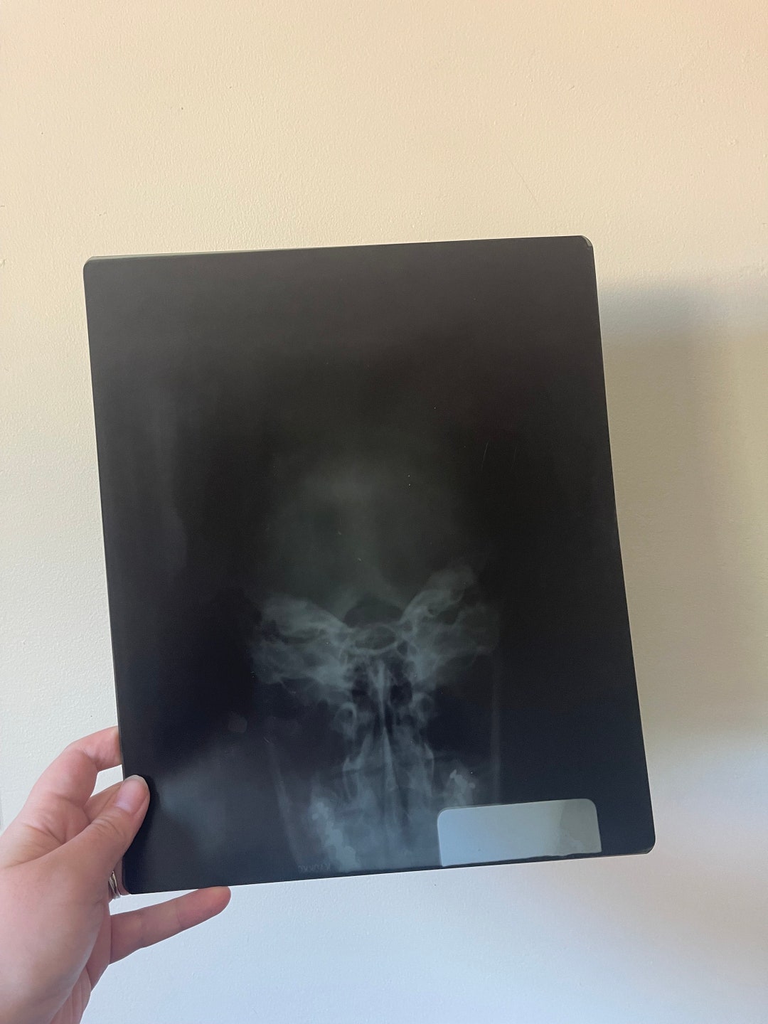 Vintage X Ray of the Human Skull Front View - Etsy