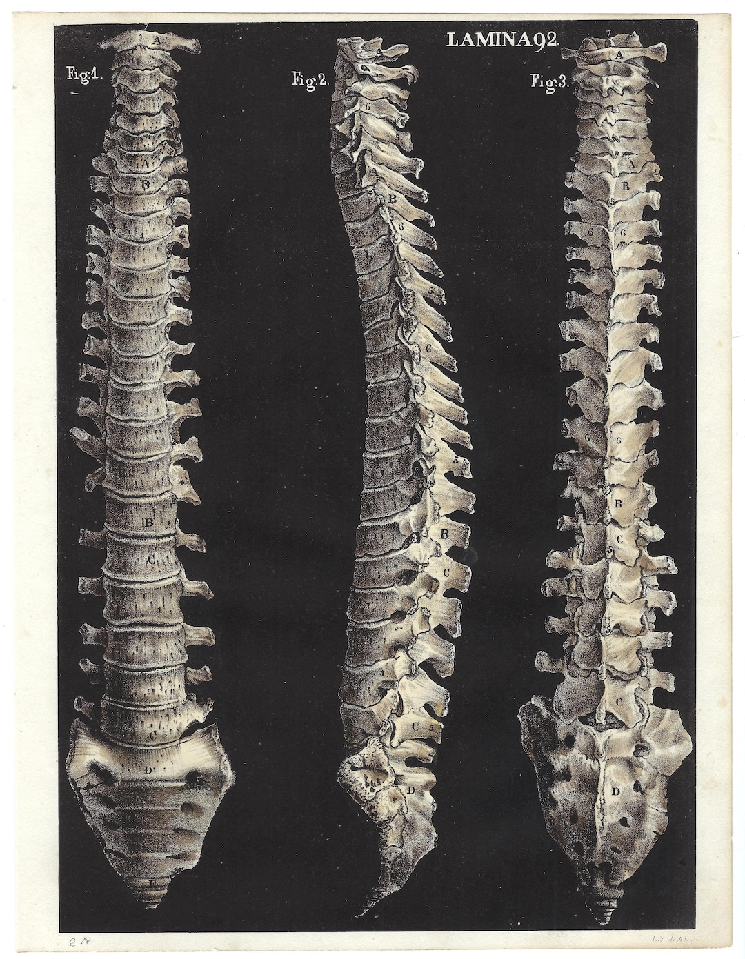 1844 ANATOMY Antique Print. SPINE, BACKBONE Original Print. Skeleton ...