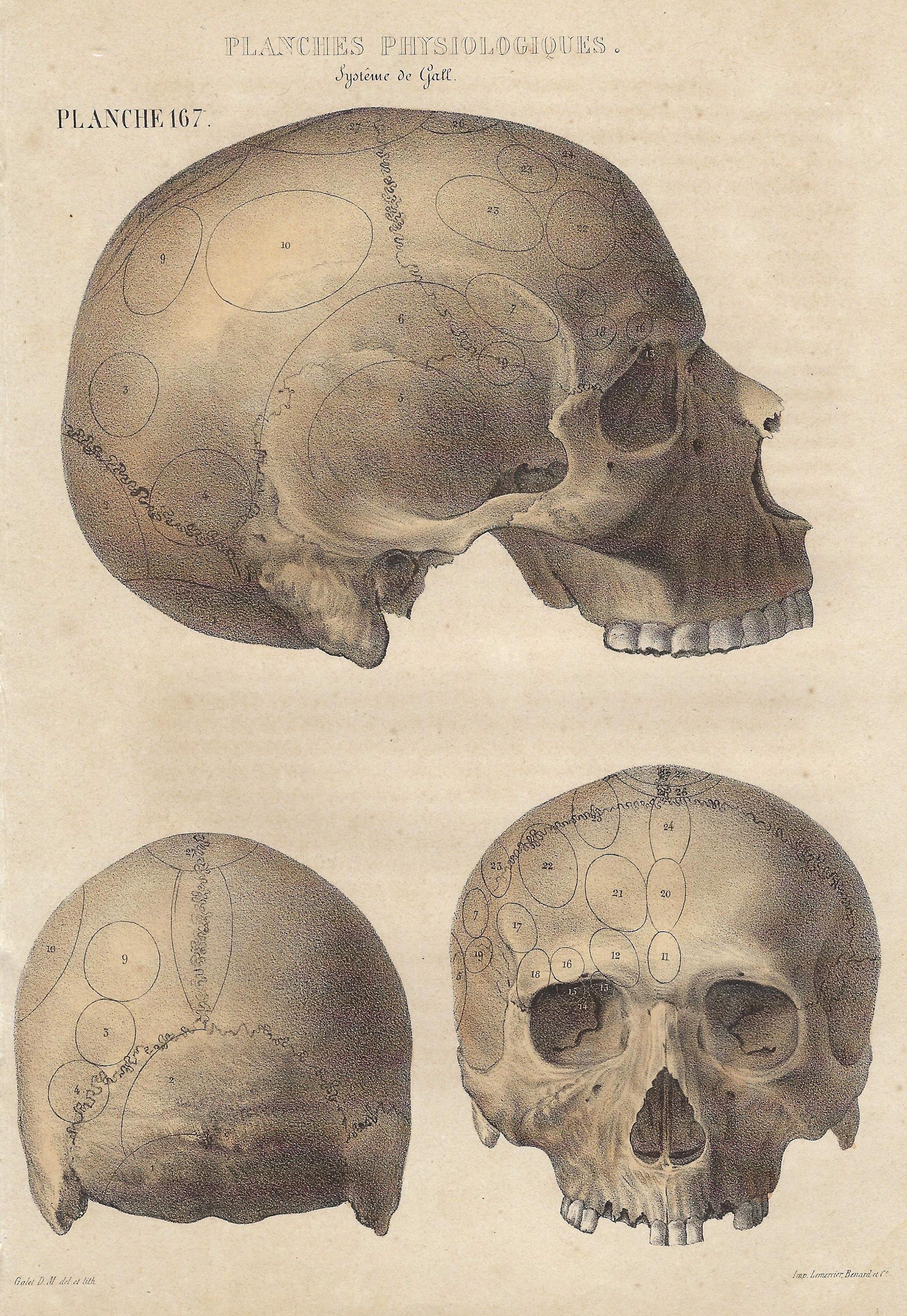 1854 Antique Human Skull Anatomy Print Vintage Medical Artwork Skeleton ...