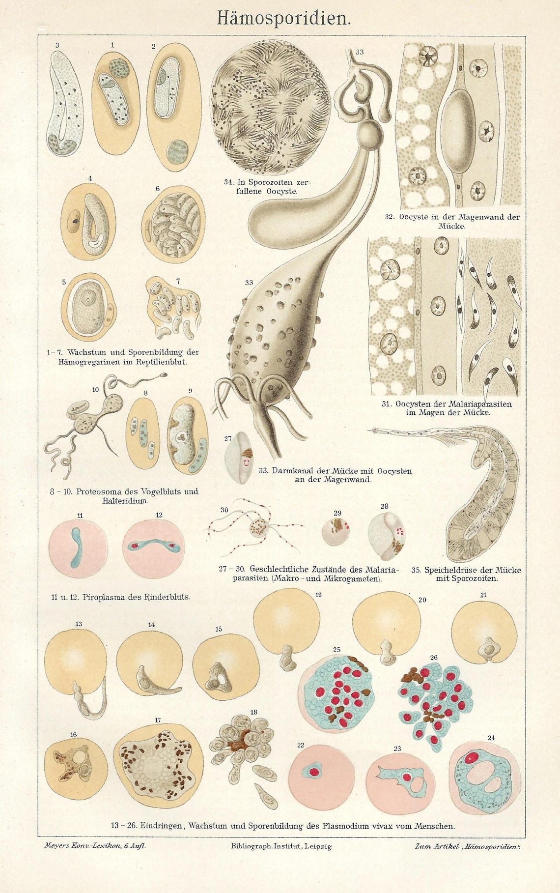 1903 Scientific Lithograph Malaria Parasites Vintage Medical Print ...