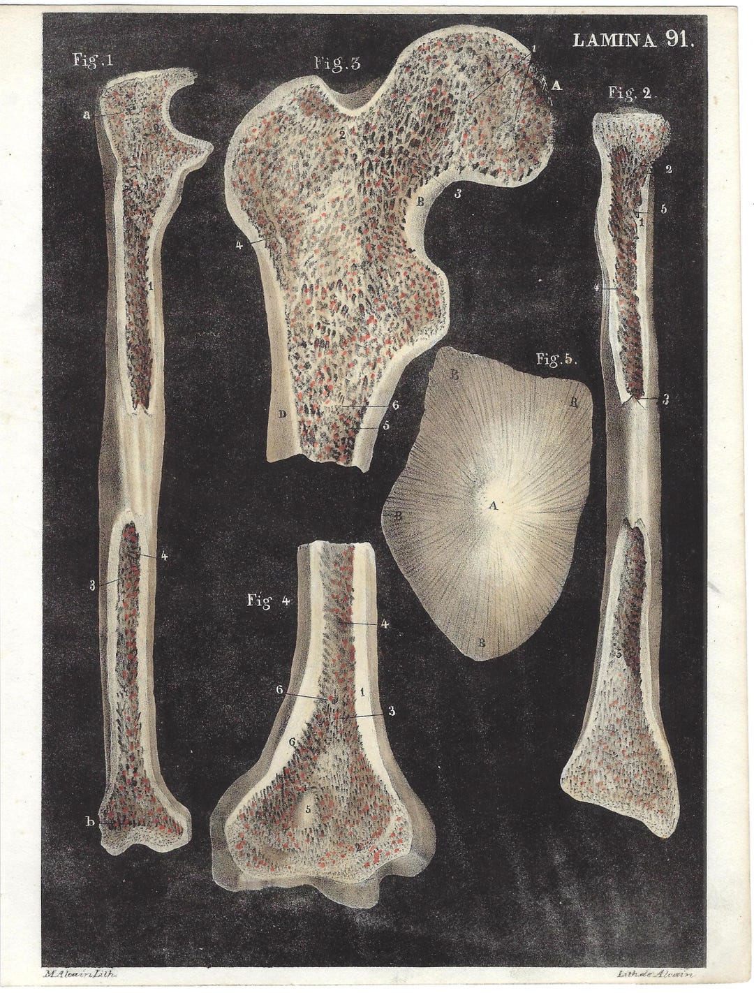 1844 - Antique ANATOMY Print Medical Wall Art Clinical Decor Vintage ...