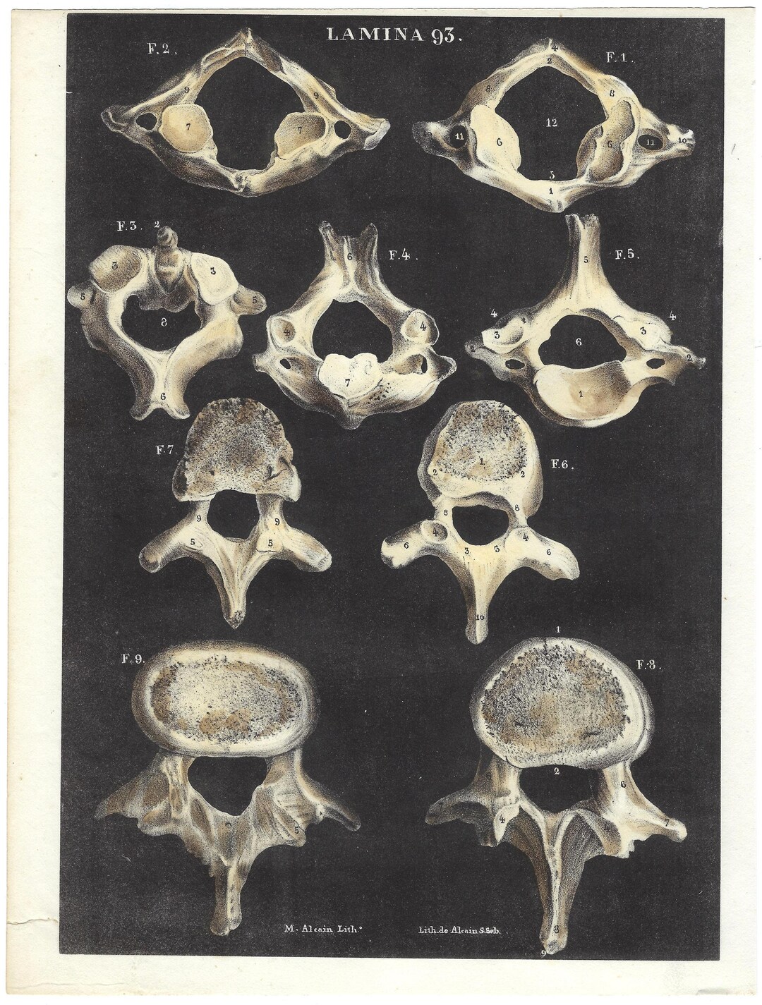 1844 Anatomical Antique Print Skeleton Wall Art Human Bones Vintage ...