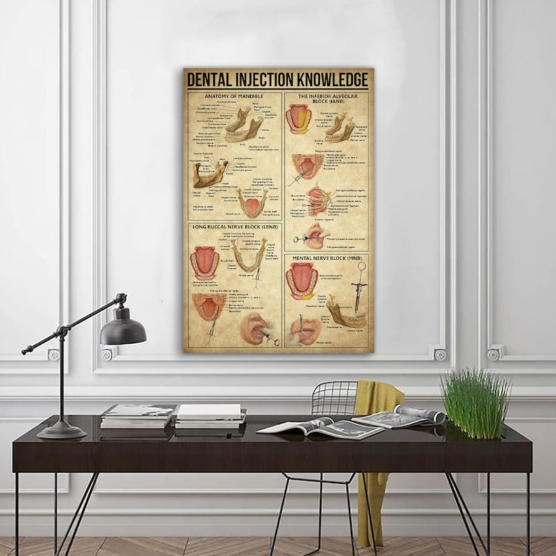 Dental Injection Knowledge Poster, Knowledge Lovers Gifts, Education ...