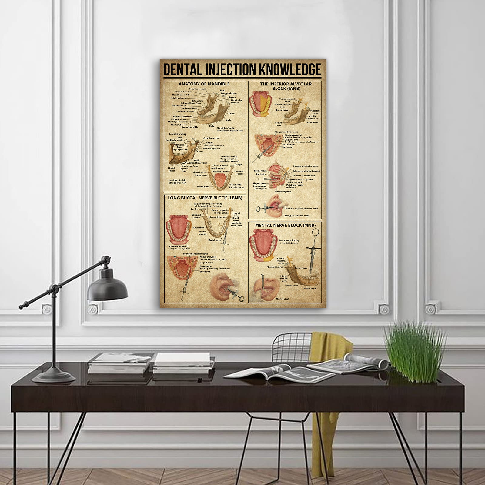 Dental Injection Knowledge Poster, Knowledge Lovers Gifts, Education ...
