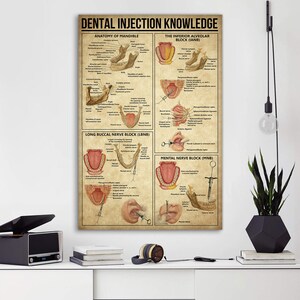 Dental Injection Knowledge Poster, Knowledge Lovers Gifts, Education ...