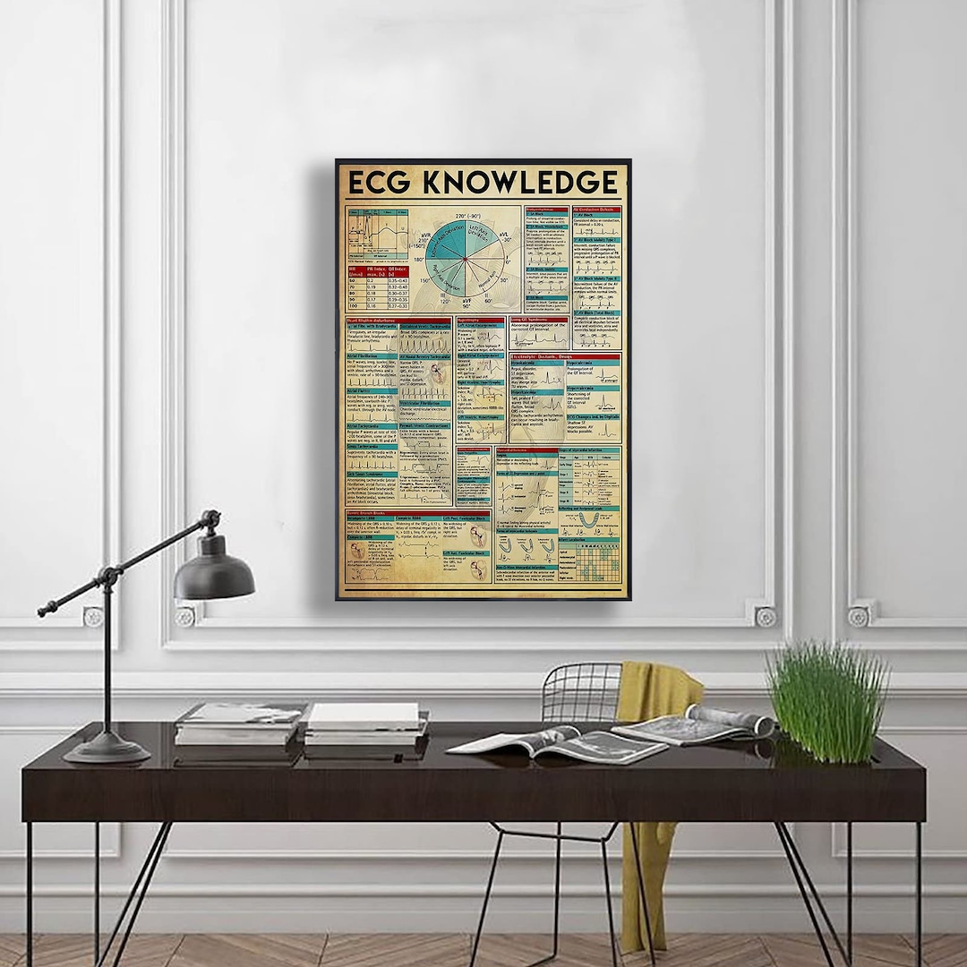 ECG Knowledge Poster Wall Art Home Decor, ECG Poster, Wall Art Home ...