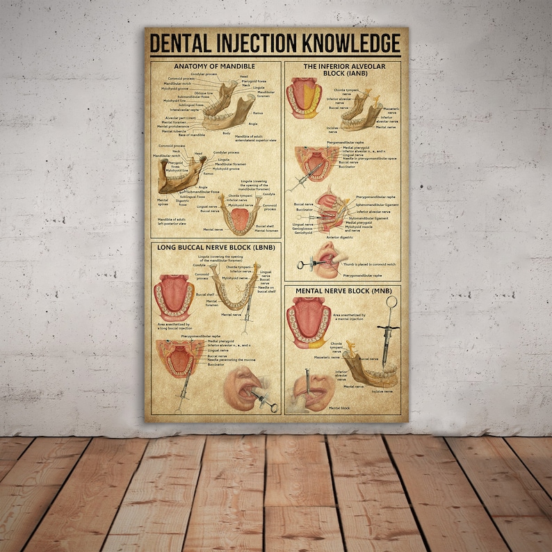 Dental Injection Knowledge Poster, Knowledge Lovers Gifts, Education ...
