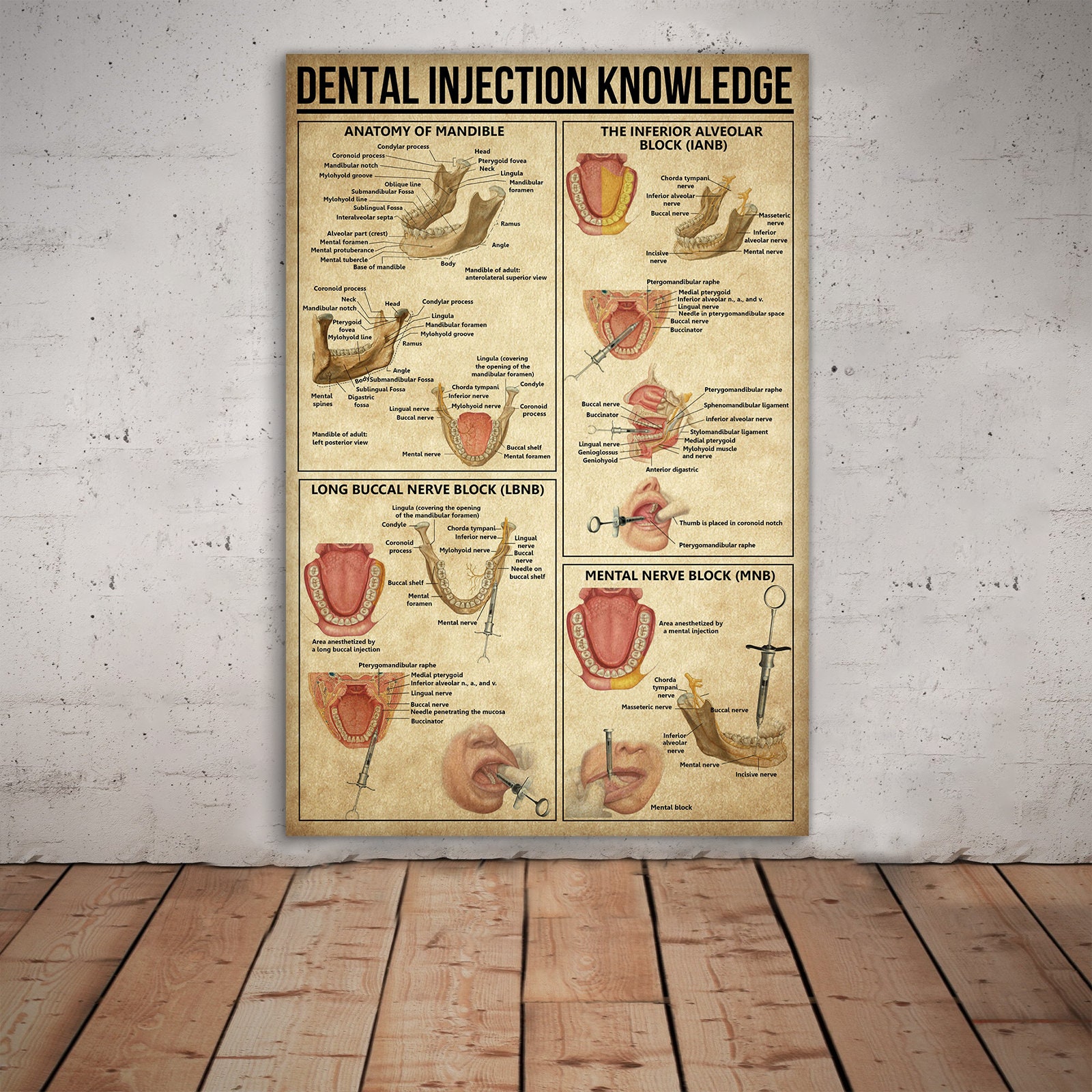 Dental Injection Knowledge Poster, Knowledge Lovers Gifts, Education ...