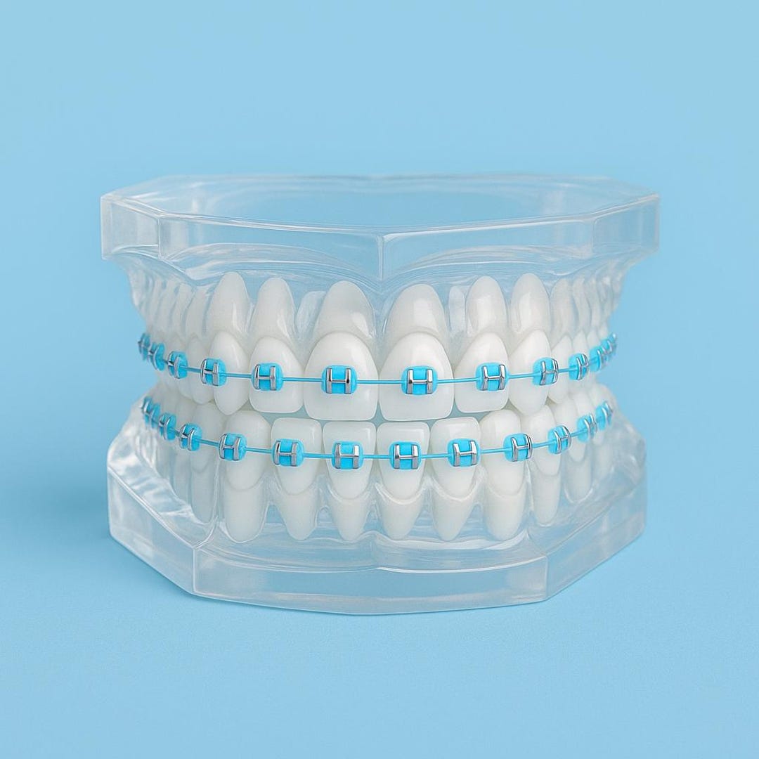 Light Blue Aesthetic Braces Jewelry,cute Tooth Gem Accessory ,kawaii ...