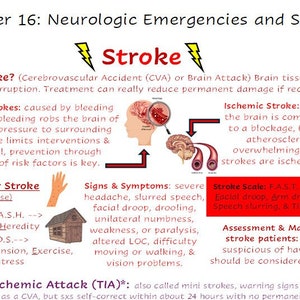 Neurologic Emergencies & Syncope EMT Crash Course Chapter 16 Notes - Etsy