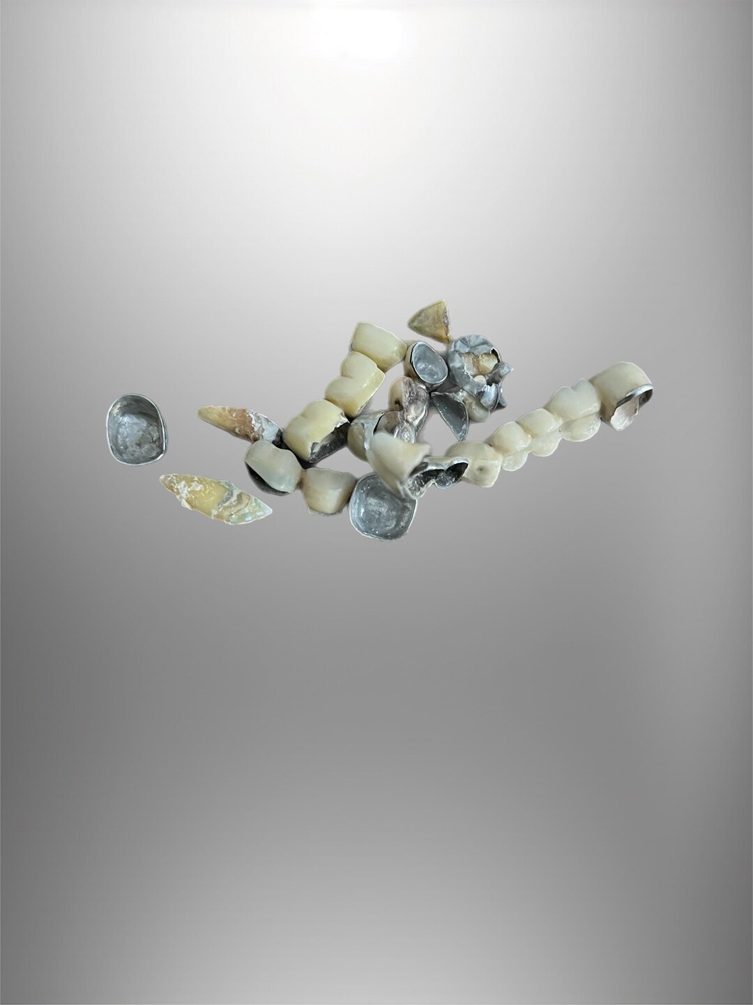 Dental Scrap Bridges & Crowns Lot for Education - 30 Grams, Dental ...