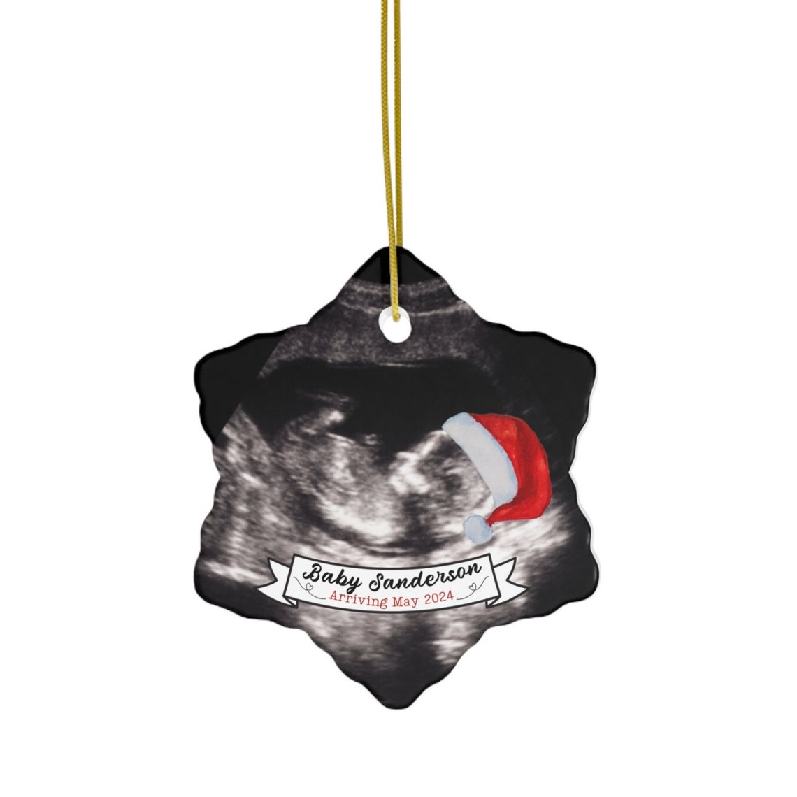 Sonogram Announcement, Ultrasound Ornament Gift, Pregnancy Announcement ...