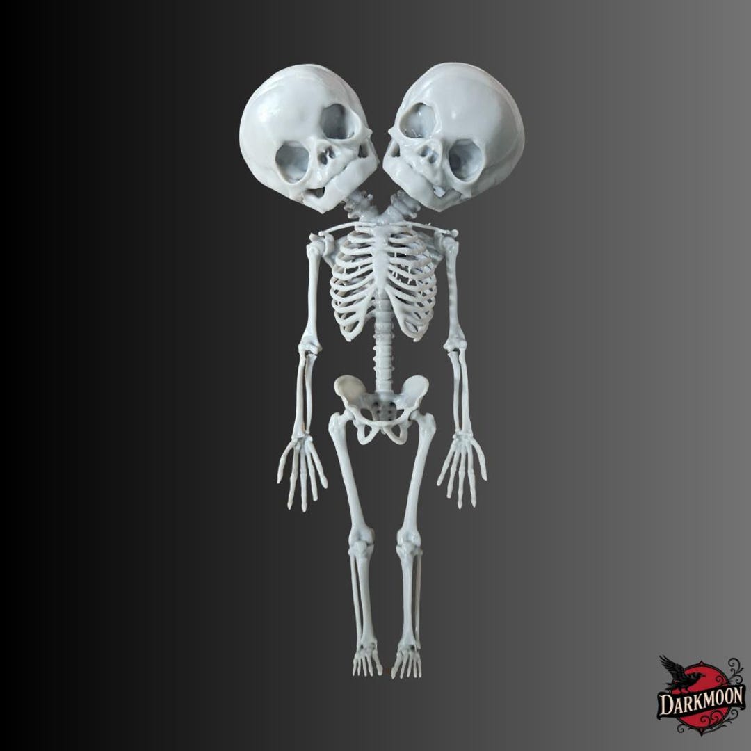 3D Printed Conjoined Human Fetus Skeleton Figurine, Hand Painted Resin ...