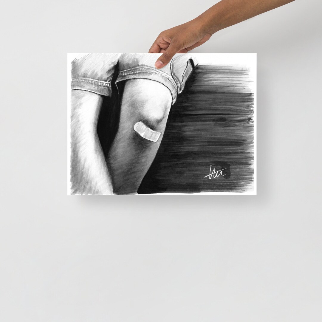 Scraped Knee Print - Etsy