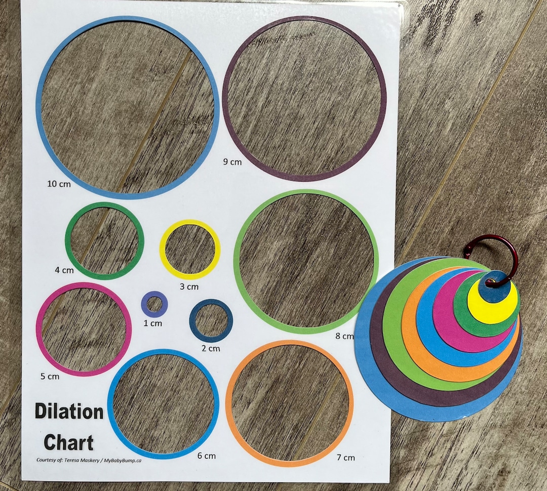 DILATION PACK: Chart and Circles 1-10cm Laminated (childbirth Educator ...