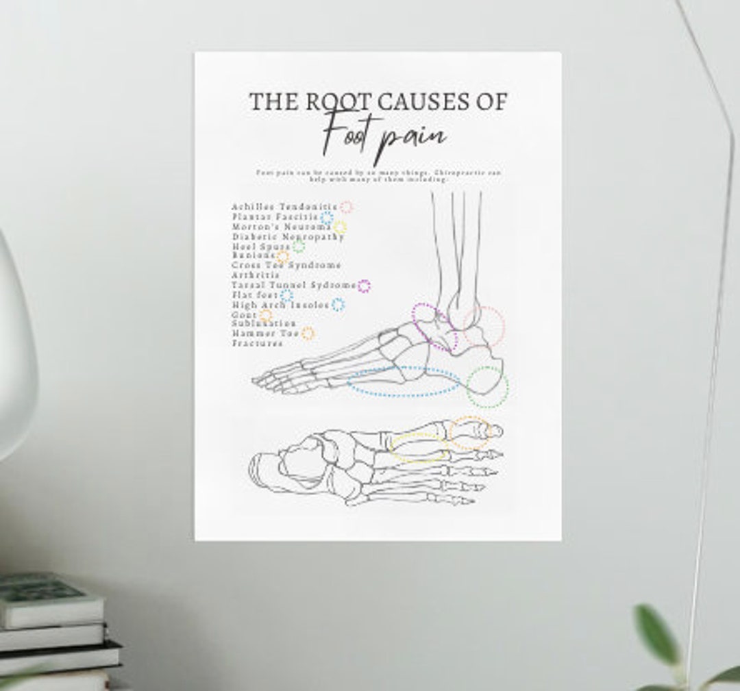 Causes of Foot Pain Chiropractic Poster - Etsy