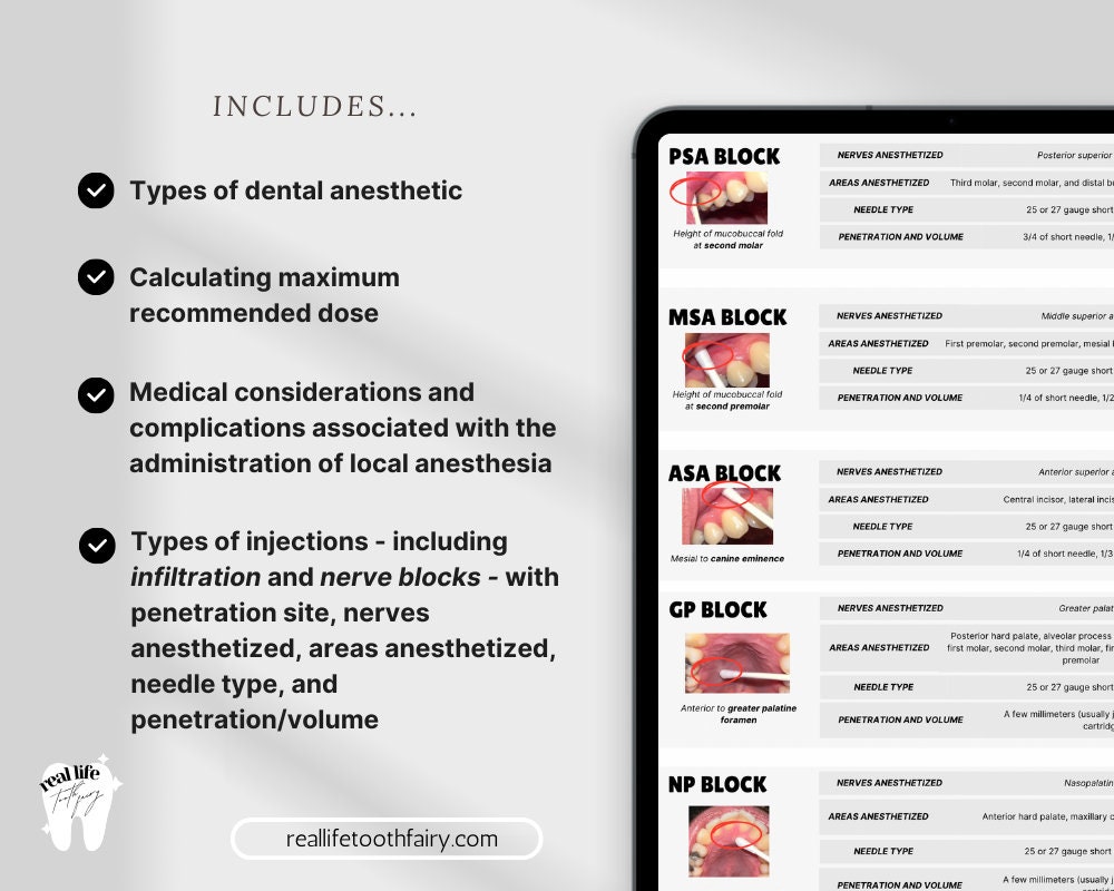 Local Anesthesia Reference Guide for the RDH digital Download RDH ...