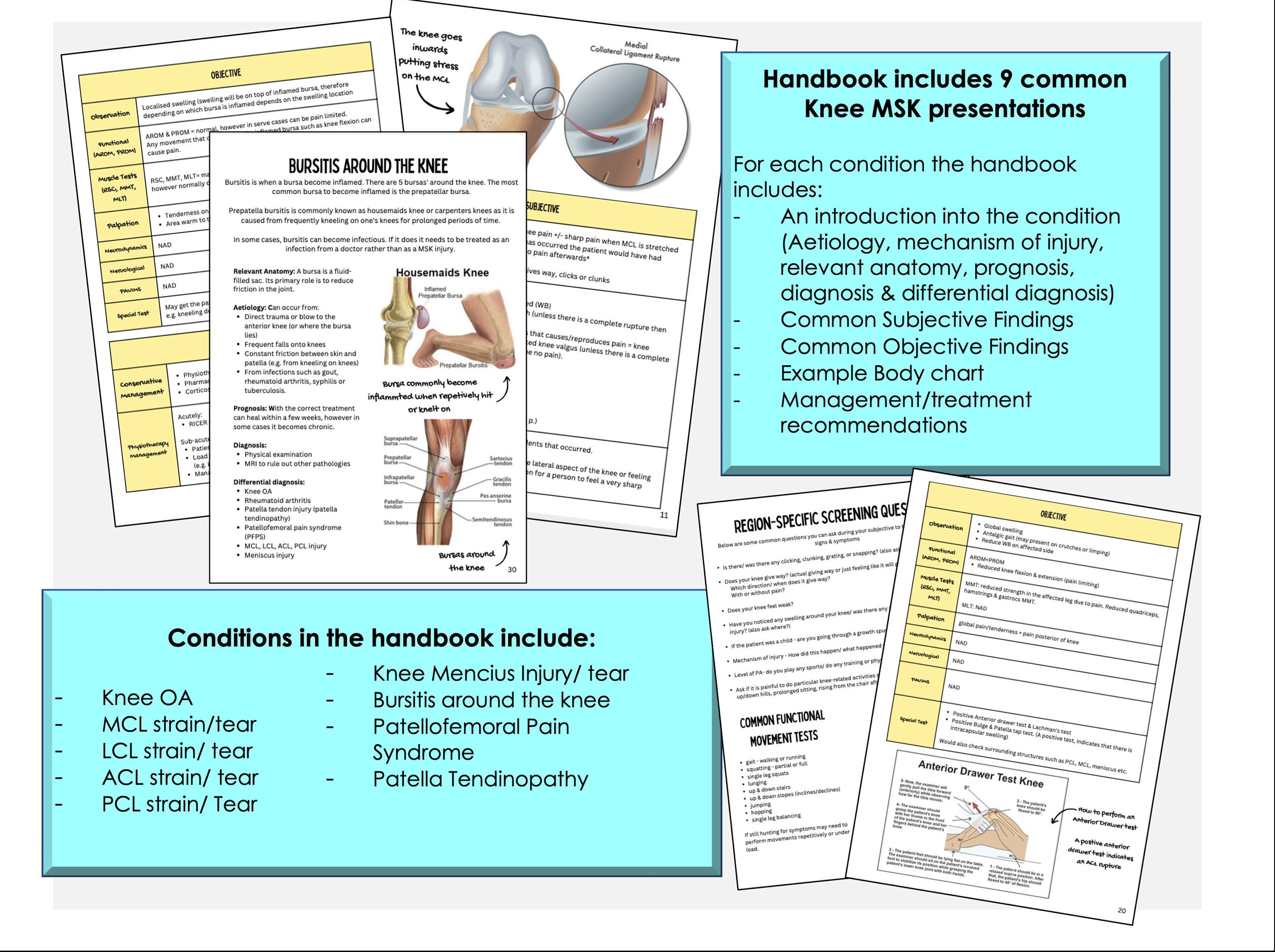 Physiotherapy Student Guide: Common Clinical Patterns of the Knee (MSK ...