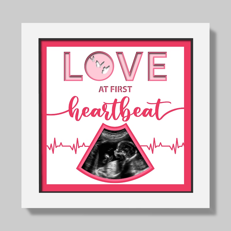 Ultra Sound Scan Frame - Etsy UK